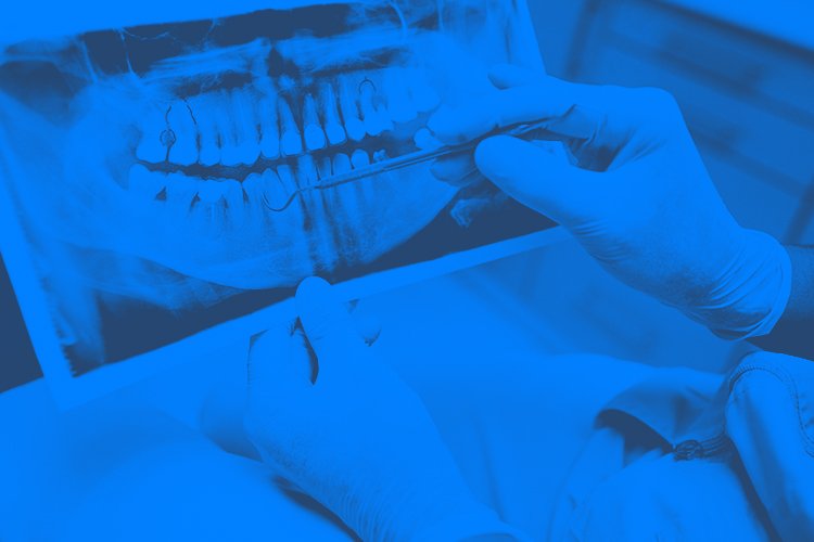 Bio Radius | Radiologia e Tomografia Odontológica