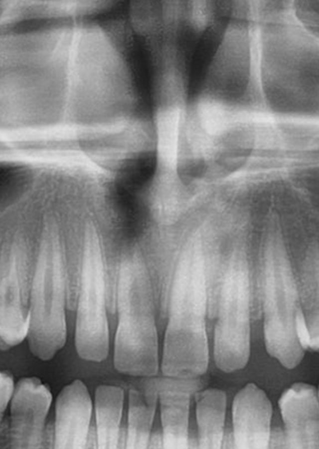 Bio Radius | Radiologia e Tomografia Odontológica