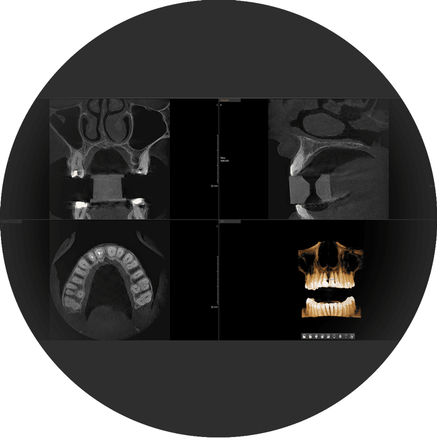 Bio Radius | Radiologia e Tomografia Odontológica