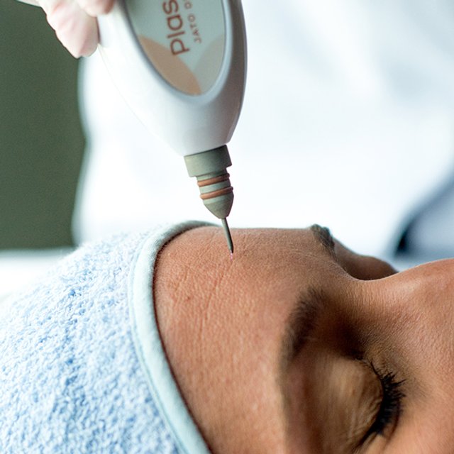 Plasmed Aparelho de Jato de Plasma Ibramed | HS Med