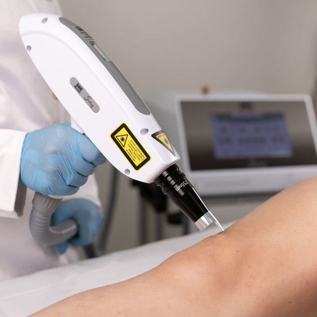 Syrius Yag Laser ND Yag Q-Switched com 04 Ponteiras - Ibramed | HS Med ...