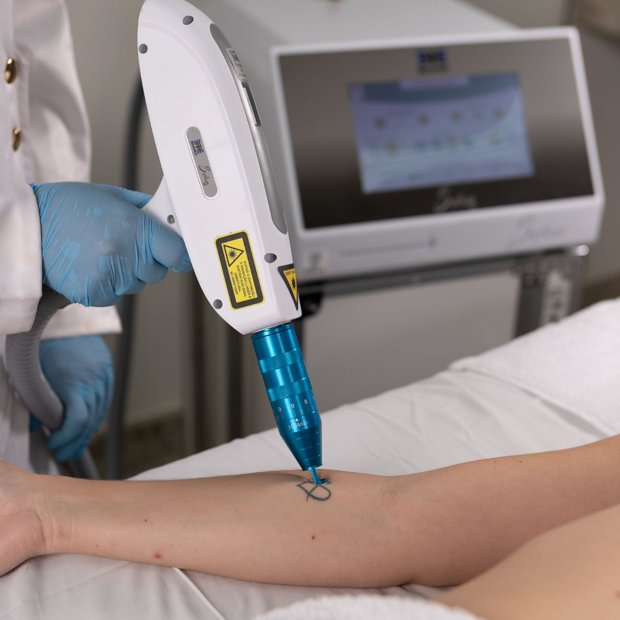 Syrius Yag Laser ND Yag Q-Switched com 04 Ponteiras - Ibramed | HS Med ...