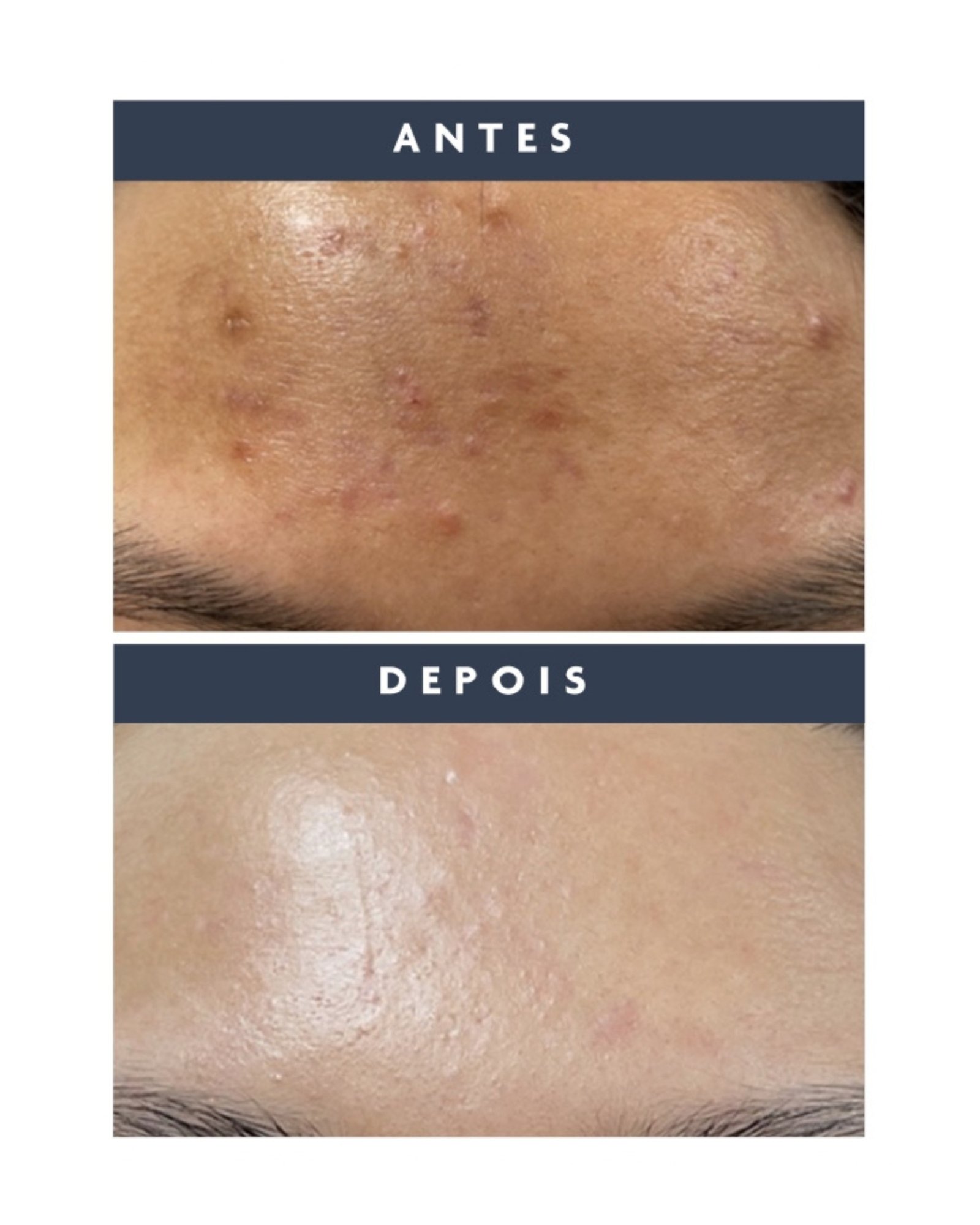 Celebrim | Equipamentos Médicos, Estética Avançada, PMU e Tatuagem ...