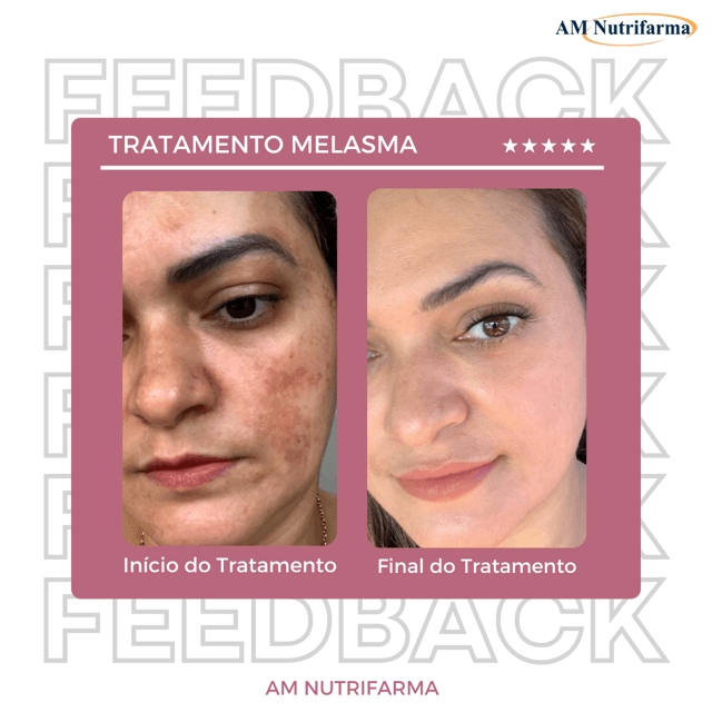 Kit Melasma com Filtro Solar em Bastão - 8 Produtos | Am Nutrifarma